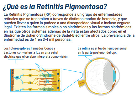 Retinitis Pigmentosa – Oculogénetica Genética Ocular Tratamiento de ...